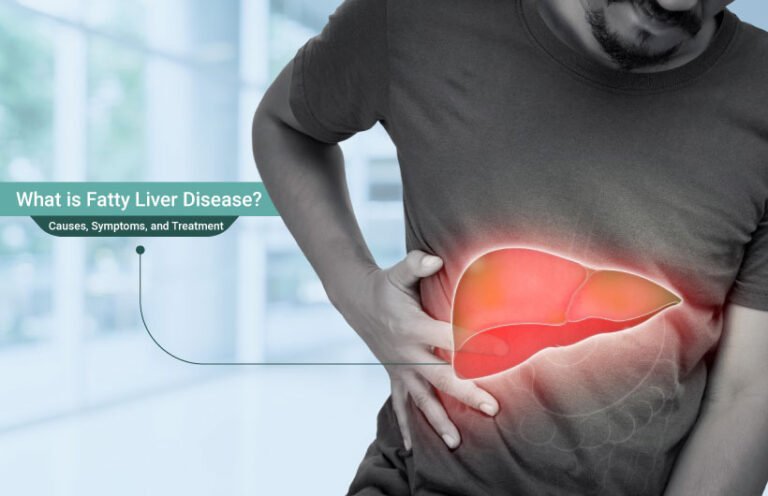 What Is Fatty Liver Disease? Causes, Symptoms, and Treatment
