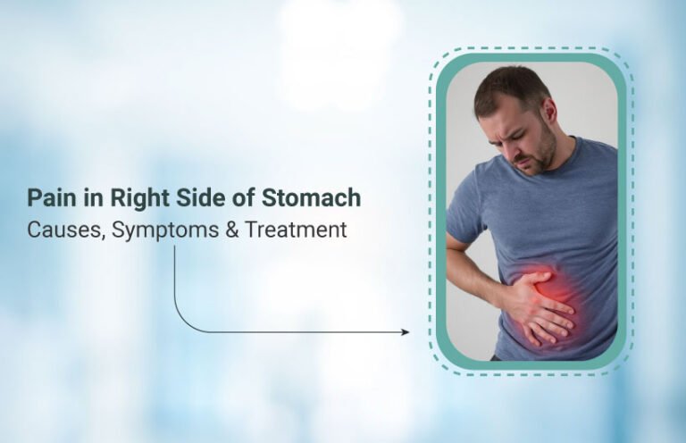 Pain in Right Side of Stomach: Causes, Symptoms & Best Treatment Guide