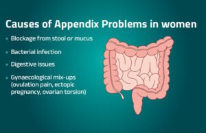Appendix in Females: Causes, Symptoms, and Treatment