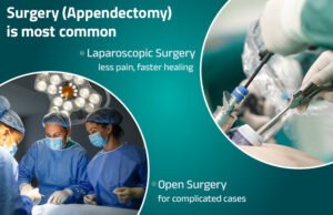 Appendix in Females: Causes, Symptoms, and Treatment