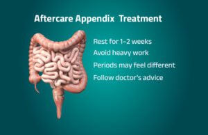 Appendix in Females: Causes, Symptoms, and Treatment